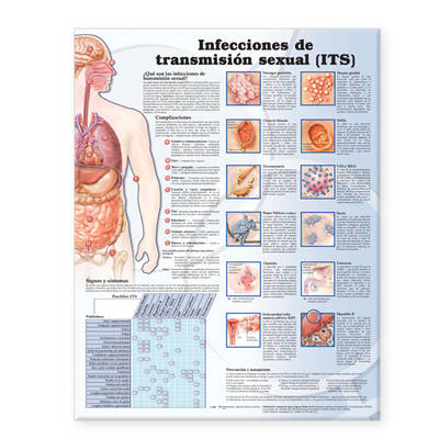 9780781773416 - Sexually Transmitted Infections Anatomical Chart in ...